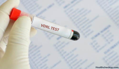 What Is A Vdrl Test Procedure Purpose Results Interpretation
