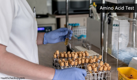 Amino Acids Test Purpose Types Tests Results Interpretation