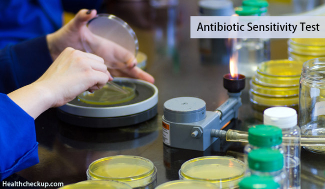 Antibiotic Sensitivity Test Results Interpretation And Procedure Antibiotic Sensitivity Test Results Interpretation And Procedure