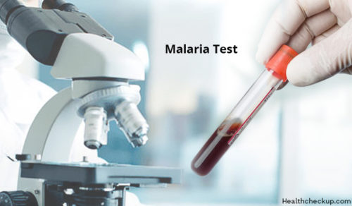 Malaria Test Procedure, Preparation, Principle, Results Interpretation Malaria Test Procedure, Preparation, Principle, Results Interpretation